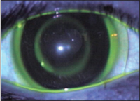 Lecturing on Orthokeratology - Charl Laas Optometrists